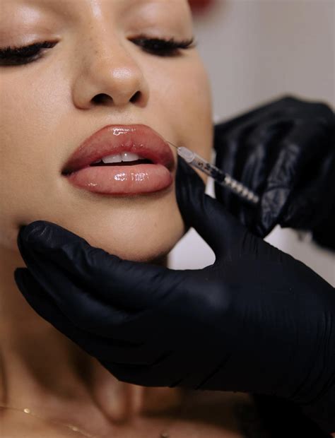 Aesthetics And Laser Wellness Rita Ghosh Md Facp A Comprehensive Guide To Hyperpigmentation