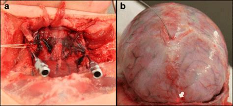 Rotational Oct Setup A Dissection And Cannulation Of The Internal Download Scientific Diagram