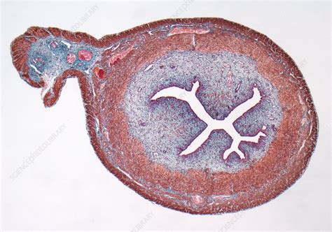 Uterus Light Micrograph Stock Image C024 3633 Science Photo Library