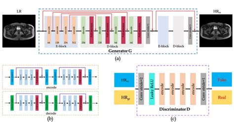 High Resolution Pelvic Mri Reconstruction Using A Generative Adversarial Network With Attention