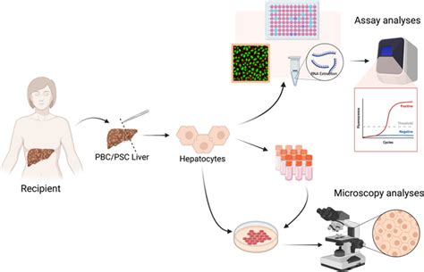 Human Hepatocellular Response In Cholestatic Liver Diseases Abstract Europe Pmc