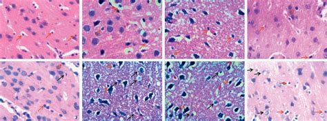 Photomicrographs Of The Outer Granular Pyramidal Layer Of The Cerebral Download Scientific