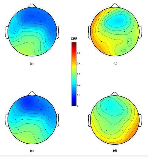 Average Scalp Topographies Of Significant Crr For Patient S4 Female