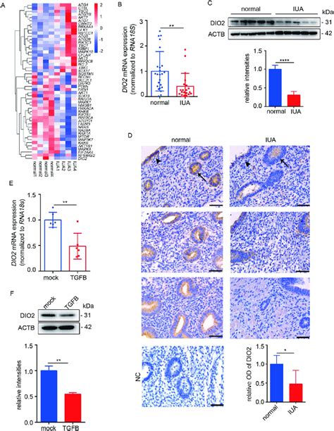 Dio2 Is Downregulated In Endometria Of Iua Patients A Heatmap