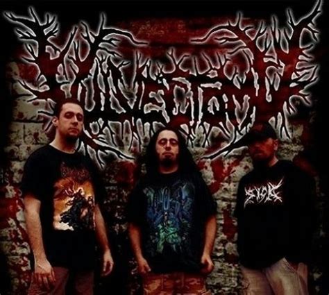 Vulvectomy Wiki Metal Amino