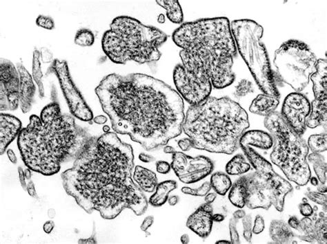 Nipah Virus Educational Institutions To Function Normally In Kozhikode