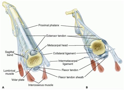 Metacarpophalangeal Joint Synovectomy And Extensor Tendon Centralization In The Inflammatory