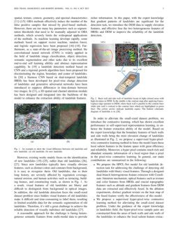 A Hyper Pixel Wise Contrastive Learning Augmented Segmentation Network For Old Landslide