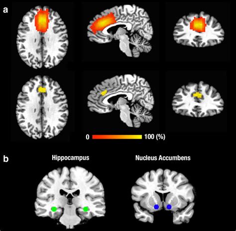 Regions Of Interest For Resting State Functional Connectivity RsFC Download Scientific
