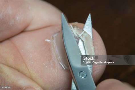 손톱 가위로 발톱을 자르는 남자의 클로즈업 매크로 사진 가위에 대한 스톡 사진 및 기타 이미지 가위 각질제거 개념 Istock