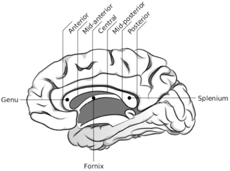 Corpus Callosum Parts