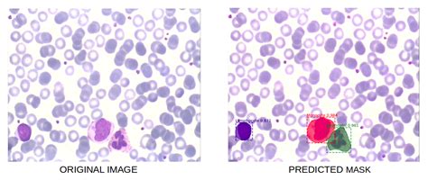 Github Jebastin Nadarinstance Segmentation On Wbc Using Mask Rcnn