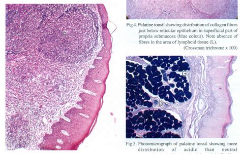 Labeled Tonsil Histology At Linda Moulton Blog
