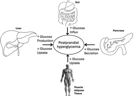Full Article Manipulation Of Post Prandial Hyperglycaemia In Type 2