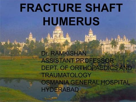 Muller Ao Classification Pdf