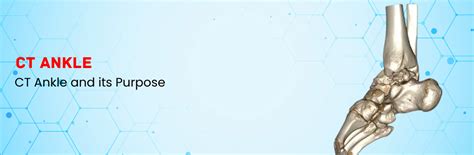 Detailed Ct Ankle Scan And Its Purpose Ganesh Diagnostic