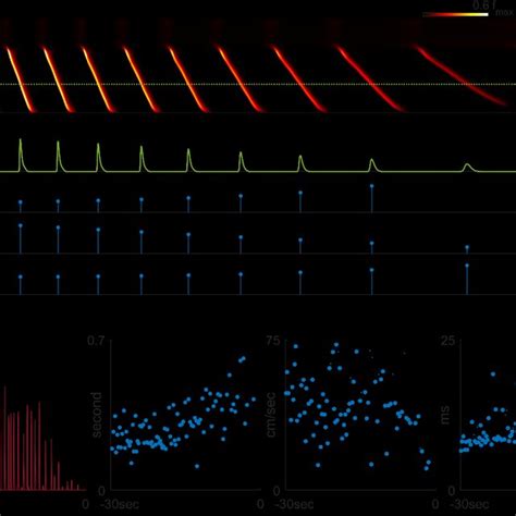 Subtypes Of Seizure Onset Pattern Can Arise From Different