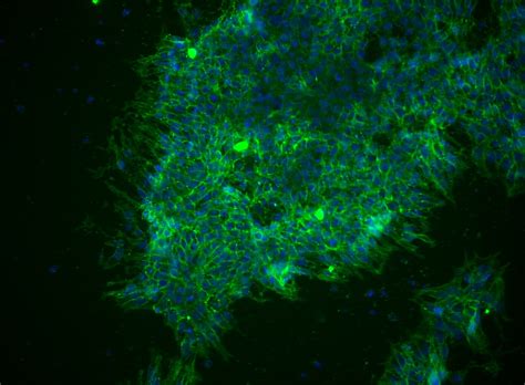 Purified Mouse Anti Human Alkaline Phosphatase