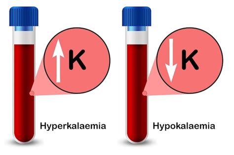 Premium Photo Hyperkalaemia And Hypokalaemia With Blood Shape
