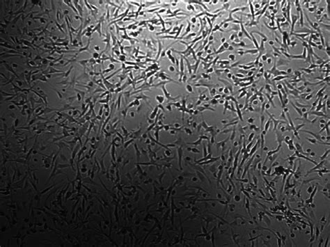 Morphology Of GBM Derived Adherent Cells GBM ACs Download Scientific Diagram