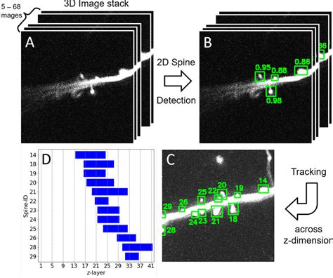 Overview Of Spine Detection Pipeline Illustrated Using One Example