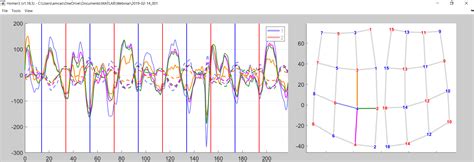 Fnirs Analysis Nirs Analysis Techniques Homer2 Nirs Toolbox Nirs Spm Nirslab Fnirs