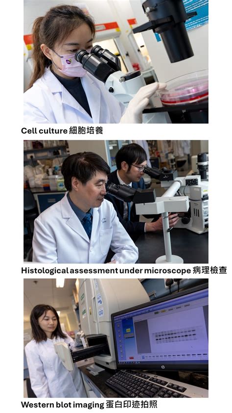 Cuhk Identifies Streptococcus Anginosus As A Pathogen That Promotes