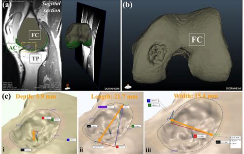 Defect Site Modeling A Identification Segmentation And 3d Modeling