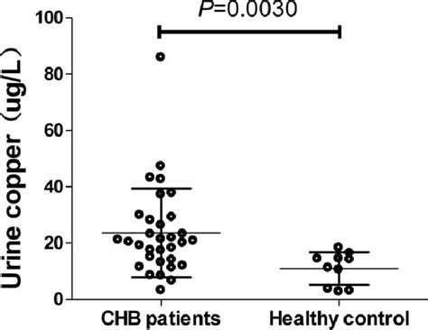 Urinary Total Copper Concentration In Patients With Chronic Hepatitis B Download Scientific