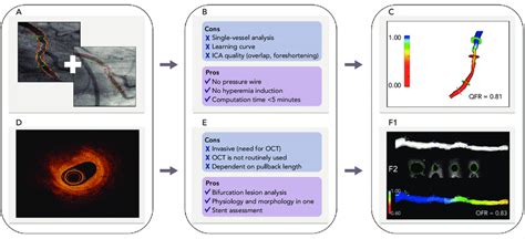 Derivation Of Quantitative Flow Ratio And Optical Coherence