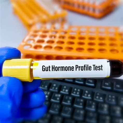 Anemia Microcytic Hypocromic Panel Motherwit Lab Jaipur