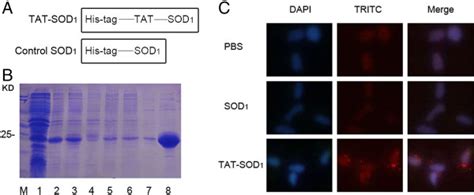 Expression And Purification Of Tat Sod1protein A Schematic Download Scientific Diagram