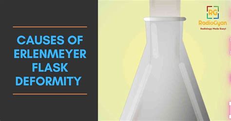 Causes Of Erlenmeyer Flask Deformity Visual Mnemonics