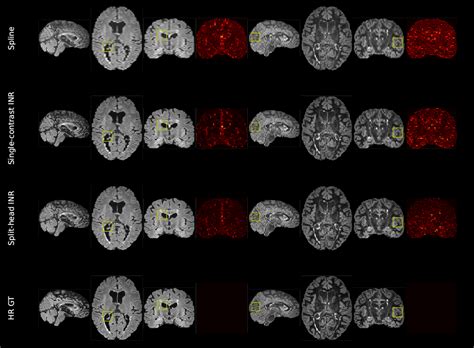 Multi Contrast Mri Super Resolution Via Implicit Neural Representations