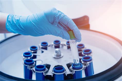 無標籤定量蛋白質組學 Label Free Quantitive Proteomics 龍欣科技股份有限公司 Edragon Technology Corporation