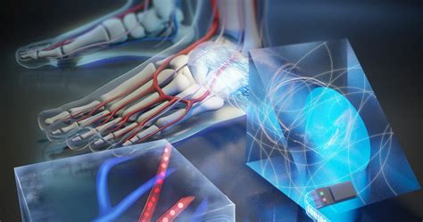 Single Shot 3d Photoacoustic Tomography Based On A Single Element
