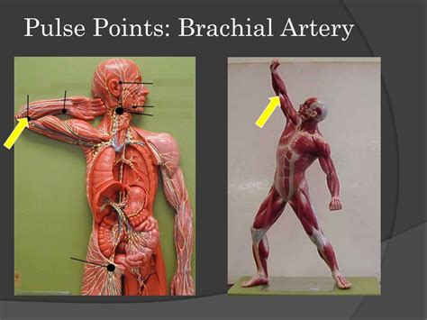 Brachial Artery Pulse