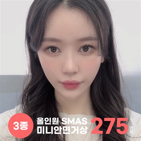 추가금없는 미니거상 3종 By 프린스성형외과의원 강남언니 1등 성형수술and피부시술 정보앱