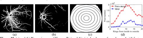 Figure 1 From Hierarchical Method For Cataract Grading Based On Retinal Images Using Improved