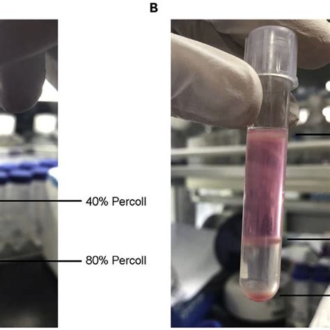 Isolation Of Lpls By Percoll Download Scientific Diagram