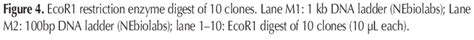 Ecor1 Restriction Enzyme Digest Of 10 Clones Lane M1 1 Kb Dna Ladder