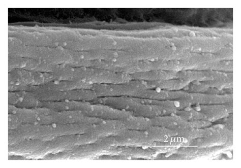 Further Section Enlargement Of A Control Nematode Showing Natural Body Download Scientific