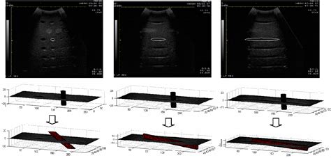 Figure 1 From 6 Dof Pose Estimation From Single Ultrasound Image Using