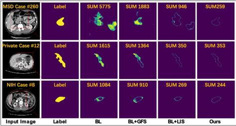 Figure 5 From Generalizable Pancreas Segmentation Via A Dual Self Supervised Learning Framework