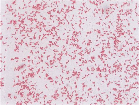 铜绿假单胞菌 临床医学 医学