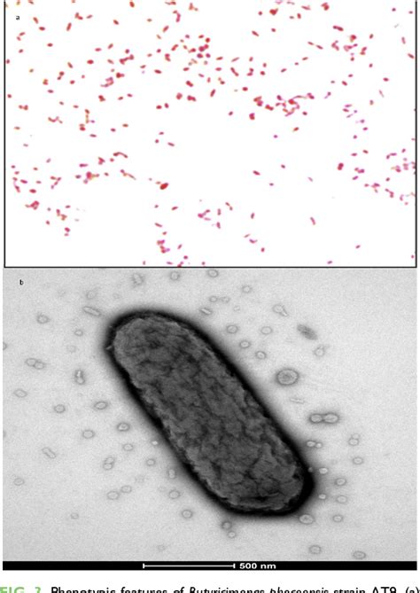 Candidatus Anaerococcus Phoceensis Semantic Scholar
