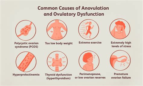 Ovulation Disorders Understanding Causes Symptoms And Treatments Aurawomen