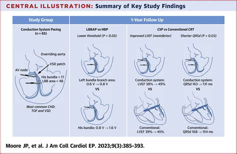 Jacc Acs Guidelines At Kaitlyn Fitzhardinge Blog