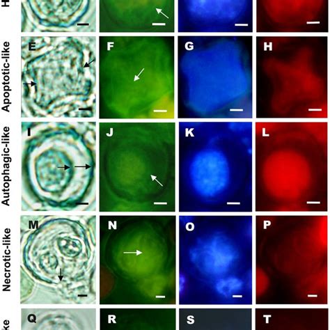 Cellular Actin Patterns In Heterocysts Passing Through Four Modes Of