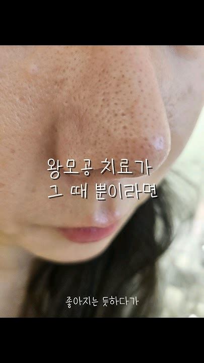 포기 하지 마세요 코모공 모공 Youtube